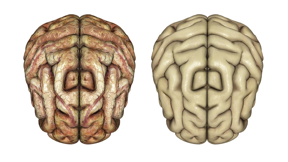 Cientistas Descobrem Proteína que Desacelera o Envelhecimento Cerebral